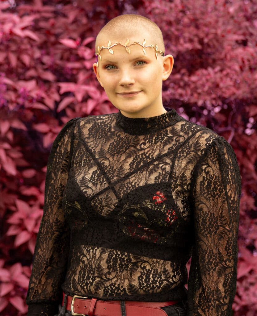 Bald Beauty: I Shaved My Head | NAIT Nugget